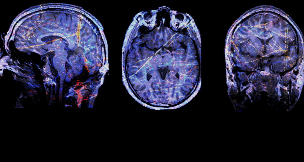 The Brain's Way of Healing: Discoveries from the Frontiers of ...